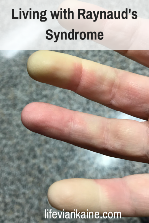 Raynaud's Syndrome Explained and How to Cope with the Symptoms - Life ...